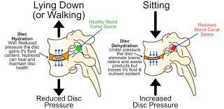Spinal Discs Go Out Drinking At Night | Forward Spine Center | Dr ...